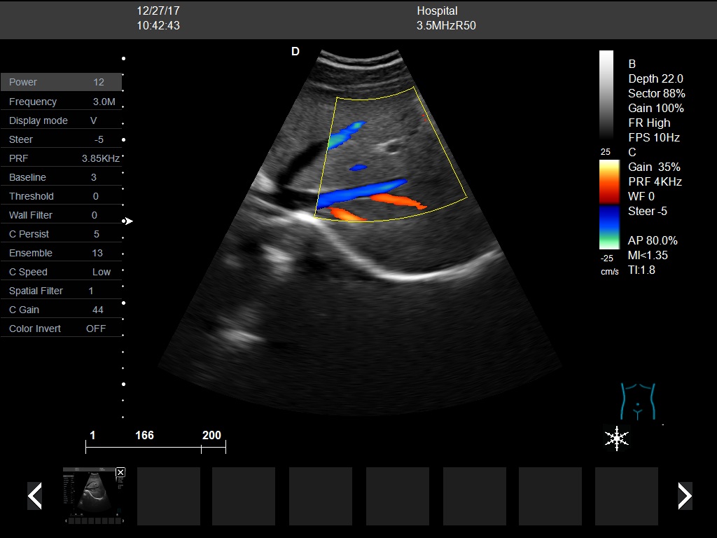 M225 Laptop Color Doppler Ultrasound Scanner